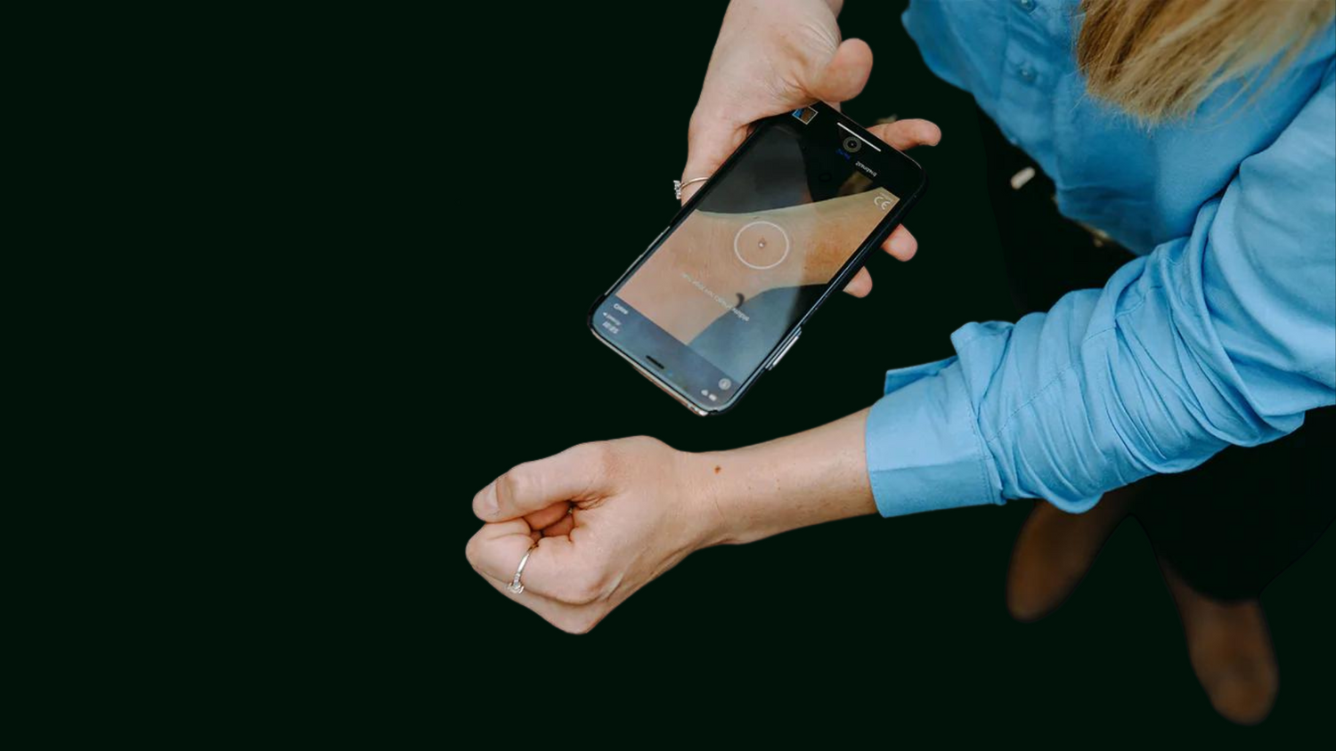 Why did we decide to launch a skin check app with SkinVision and why n ...